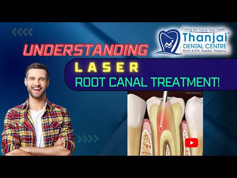 Understanding Laser Root Canal Treatment | Why People should Choose ...