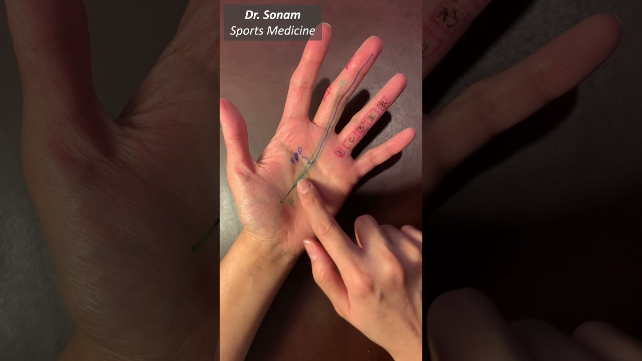 What is an A2 pulley injury (Climbers Finger) #shorts - YouTube