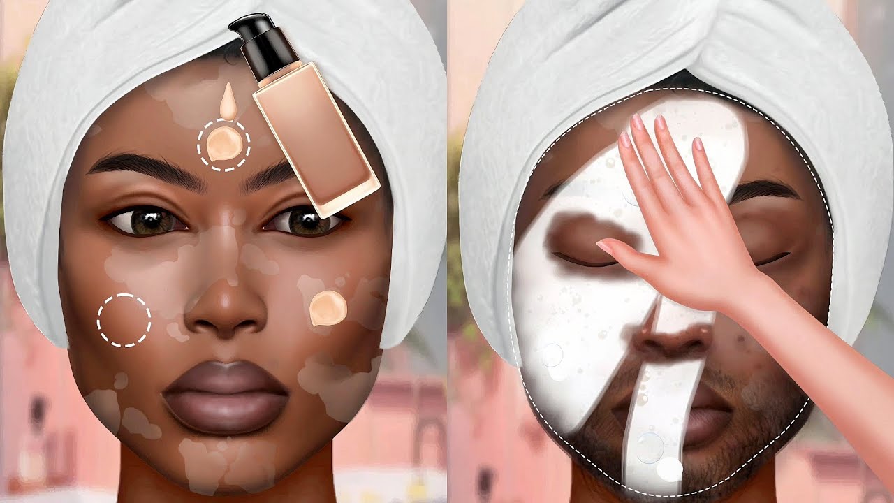 ASMR MARGOT REMOVAL TREATMENT! Face Care Roleplay Calming Experience ...