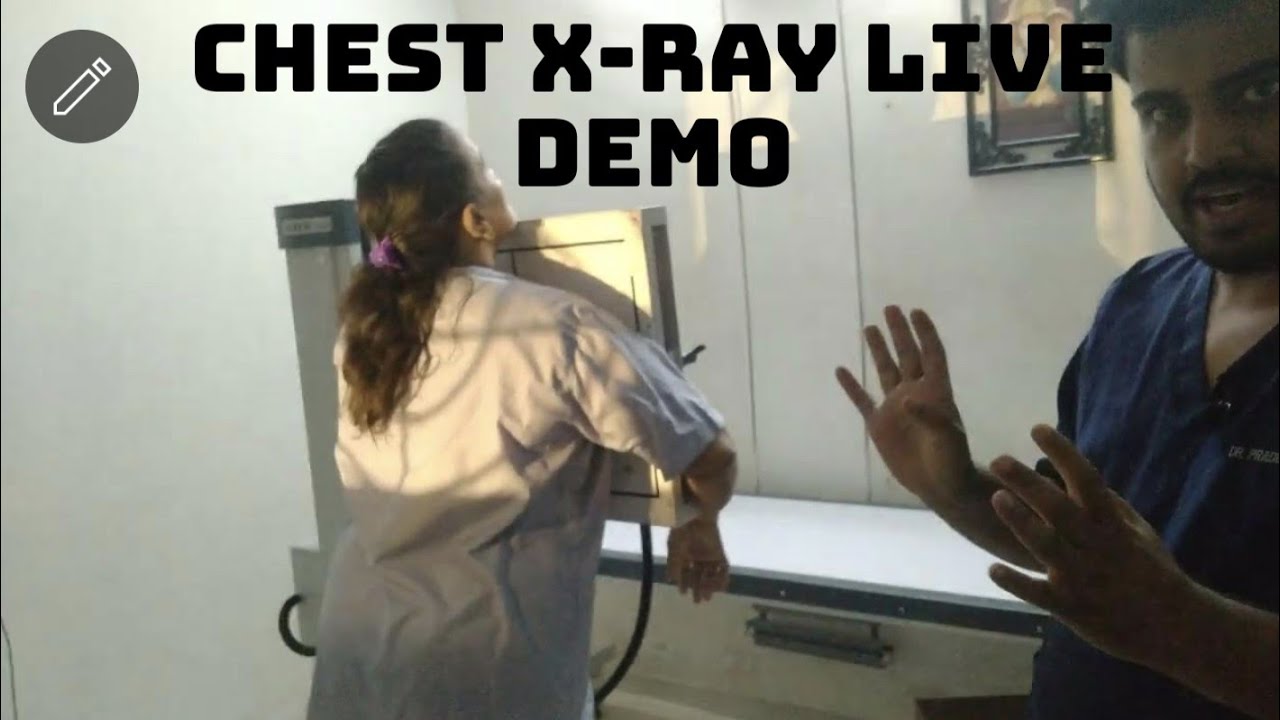 CHEST X RAY LIVE DEMO - YouTube