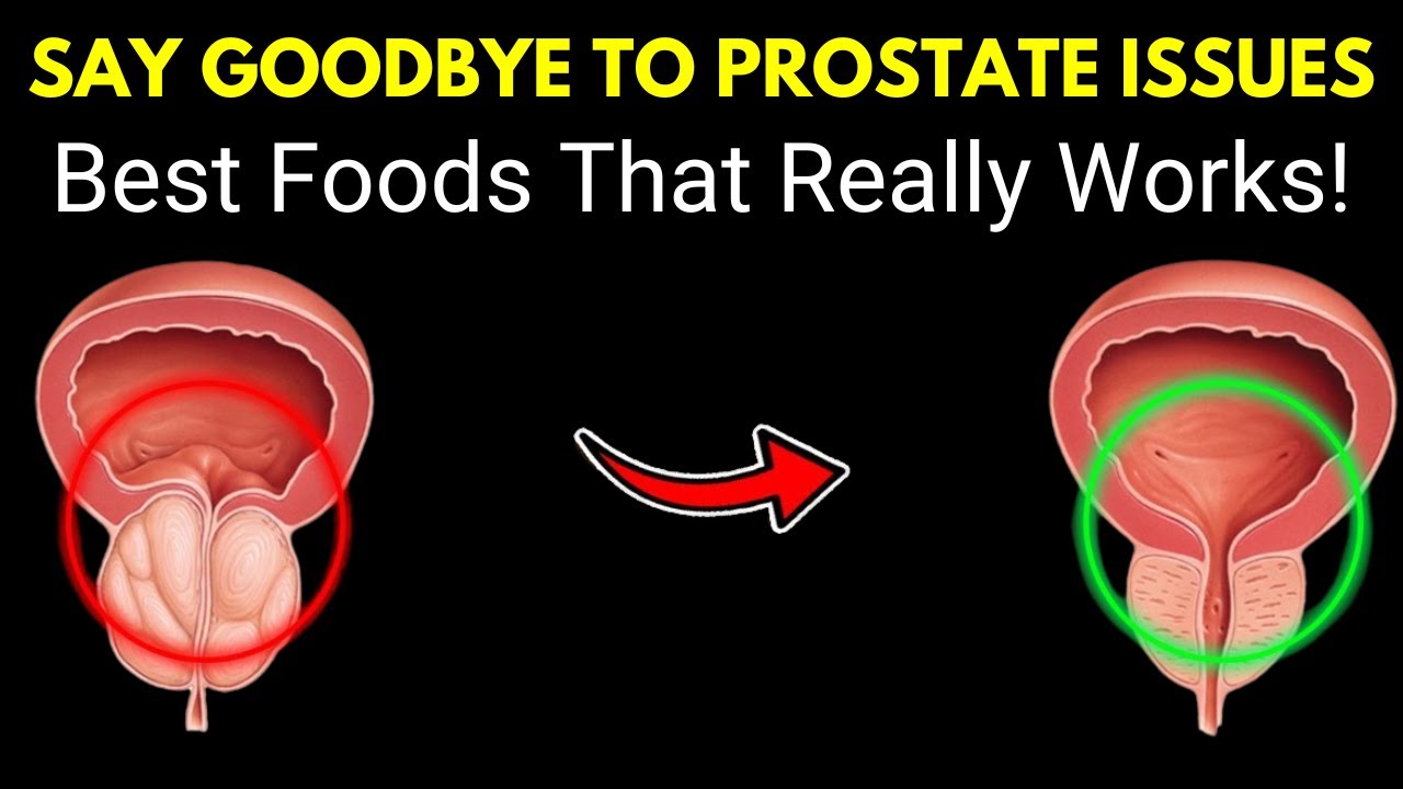 Say Goodbye to Prostate Issues: Best Foods That Really Work!! - YouTube