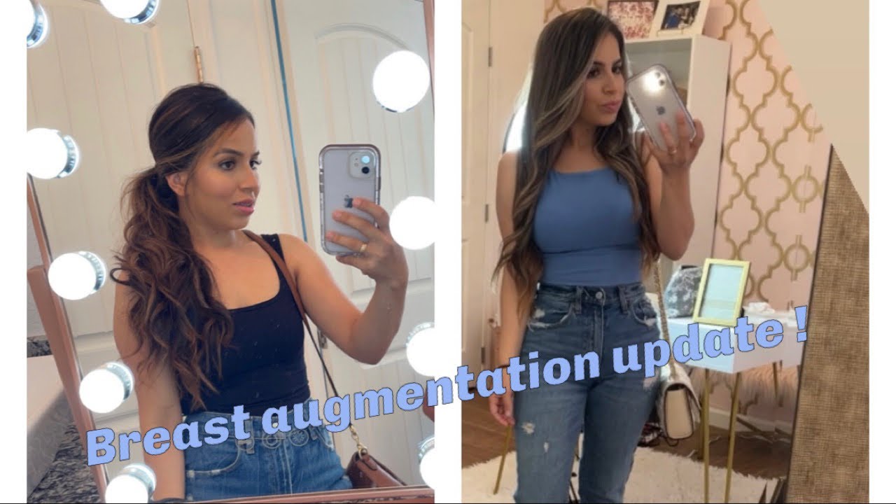 Breast Augmentation Update/ 365cc Chitchat - YouTube