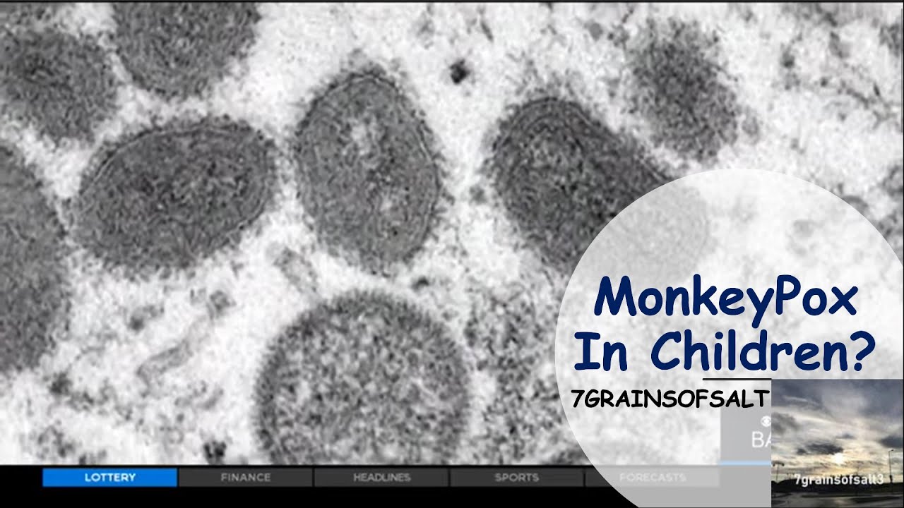 MonkeyPox In Children? - YouTube