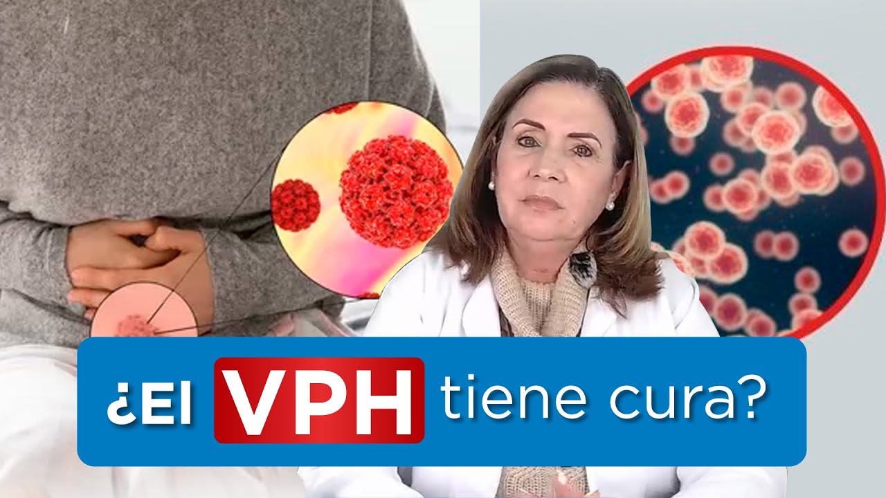 VPH ¿Conoce si tiene cura? - YouTube