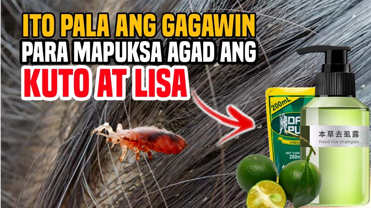 ITO PALA ANG PINAKA EPEKTIBONG PAMATAY KUTO AT LISA - YouTube