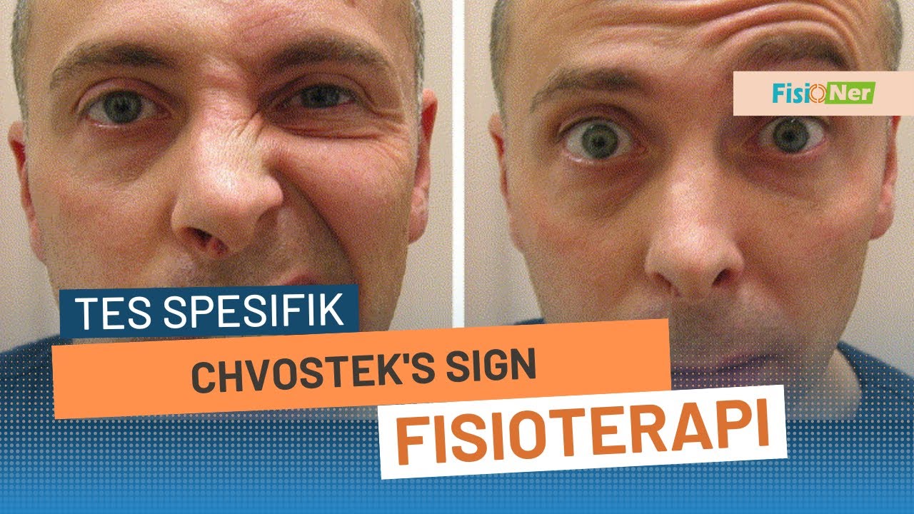 Chvostek's sign - Pemeriksaan Saraf Wajah - YouTube