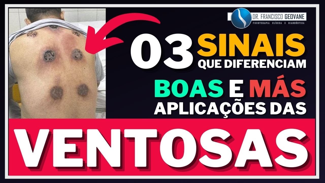 Bolhas De água Na Ventosa O Que Significa - RETOEDU