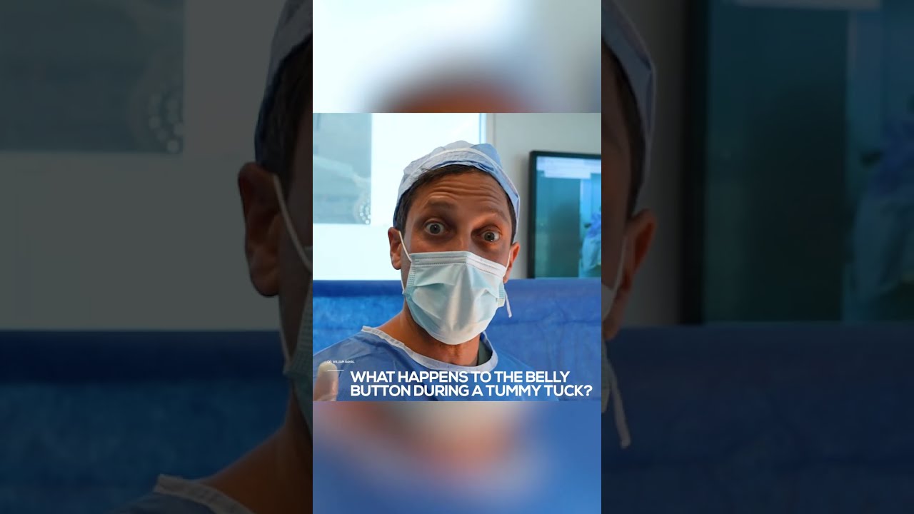 What happens to the belly button during a tummy tuck? #plasticsurgery # ...