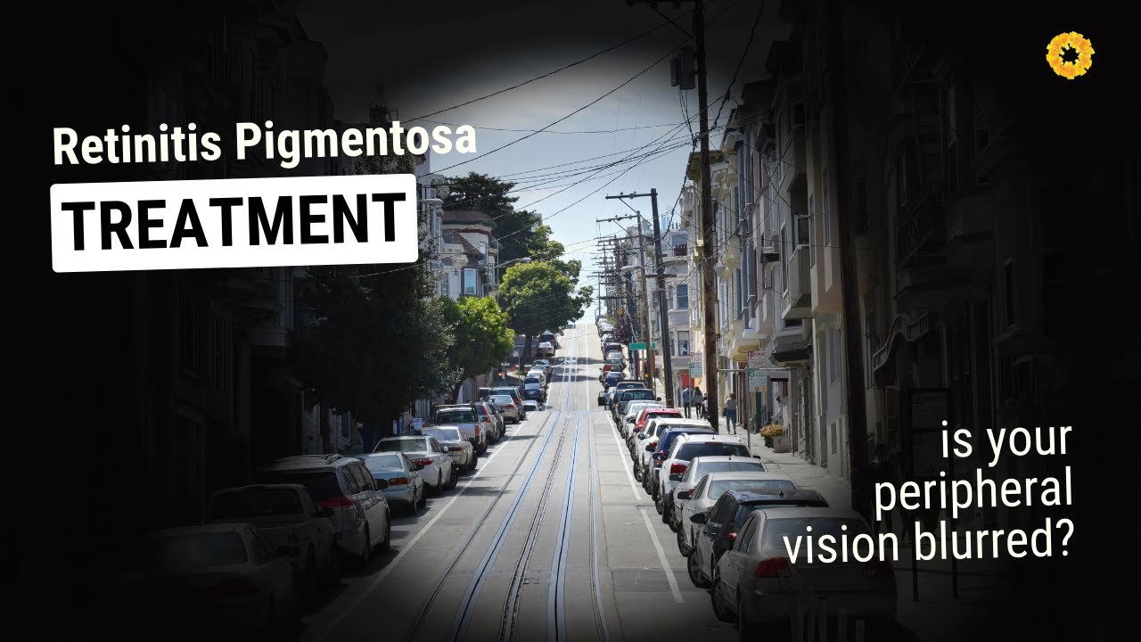 RP Treatment Succes | Retinitis Pigmentosa Treatment in India | Can ...