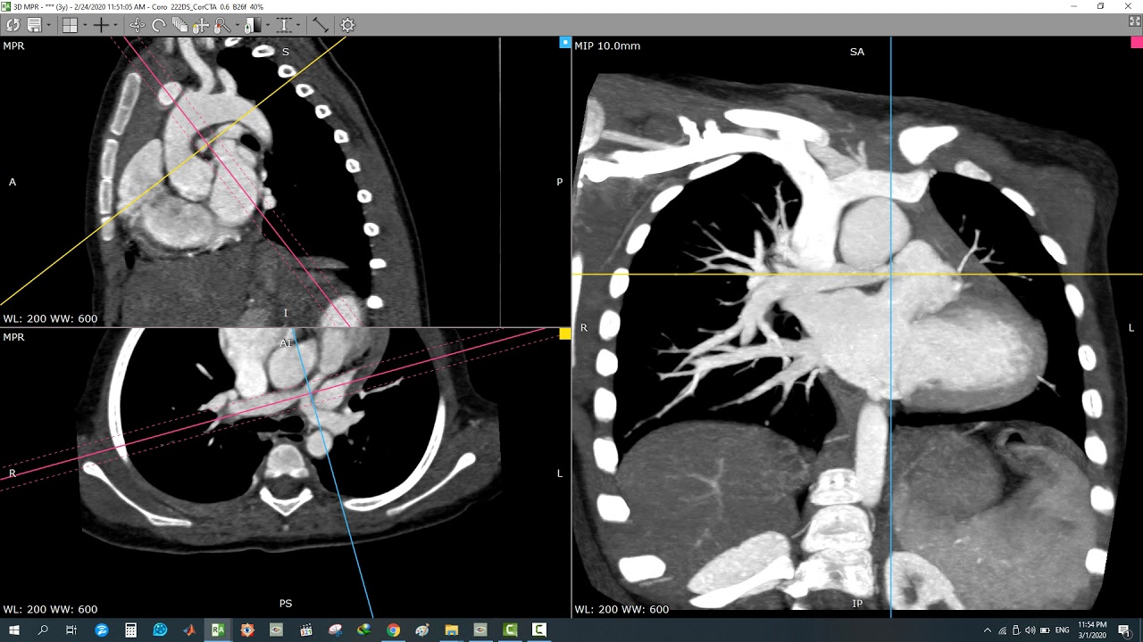 TOF Post processing upon radiant - YouTube