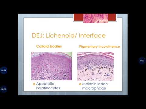 Basic Dermatopathology (5): DEJ - YouTube