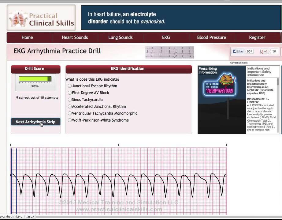 Easy EKG Rhythm Interpretation Part 2 - YouTube