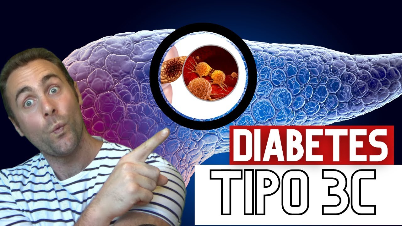DIABETES TIPO 3C [🚨] - YouTube