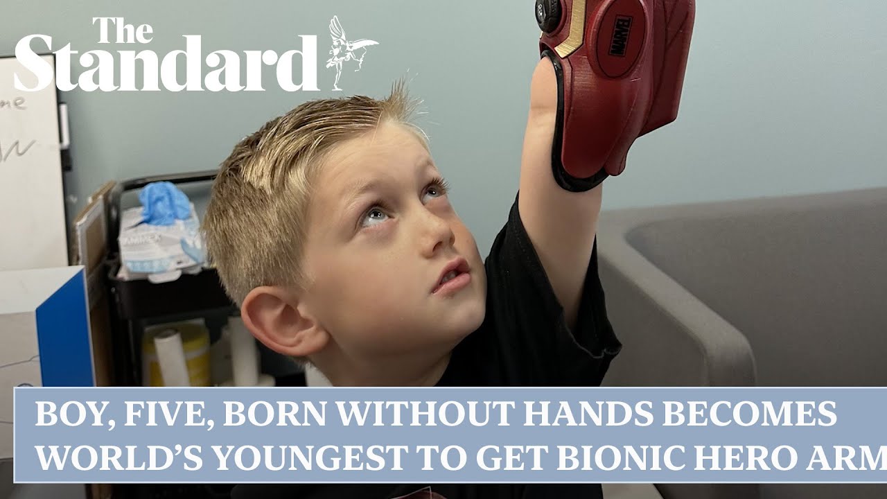 Boy, five, born without hand becomes world’s youngest to get bionic ...