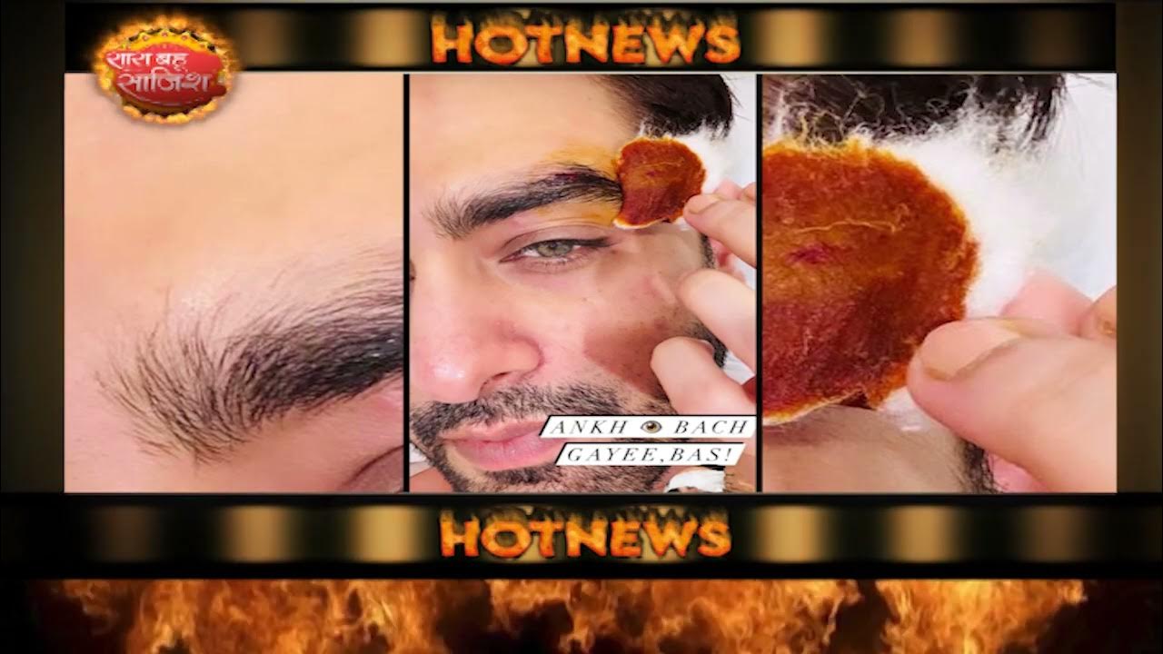 Yeh Rishta Kya Kehlata Hai: 😥 Armaan aka Rohit Purohit हुए घायल, आंख के ठीक ऊपर लगी चोट #hotnews ...