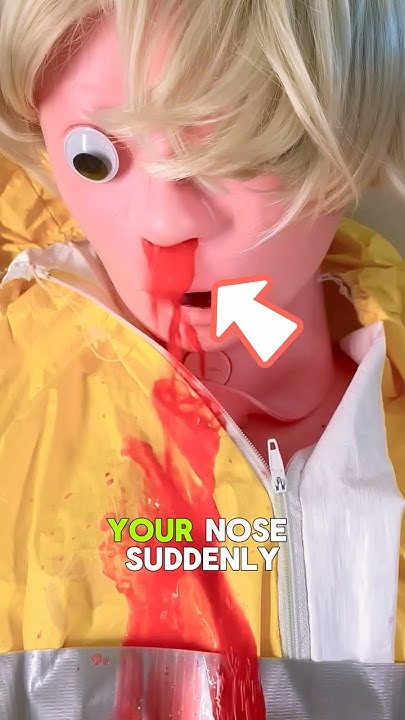 Sudden Nosebleeds? Here’s What You Should Do Immediately! - YouTube