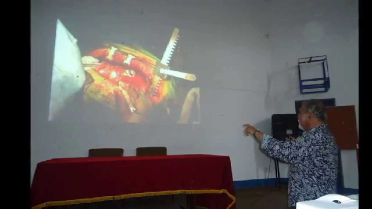 PALABRAS DEL DR. PRIMO PACHECO EN EL I CURSO INTENSIVO DE MEDICINA ...