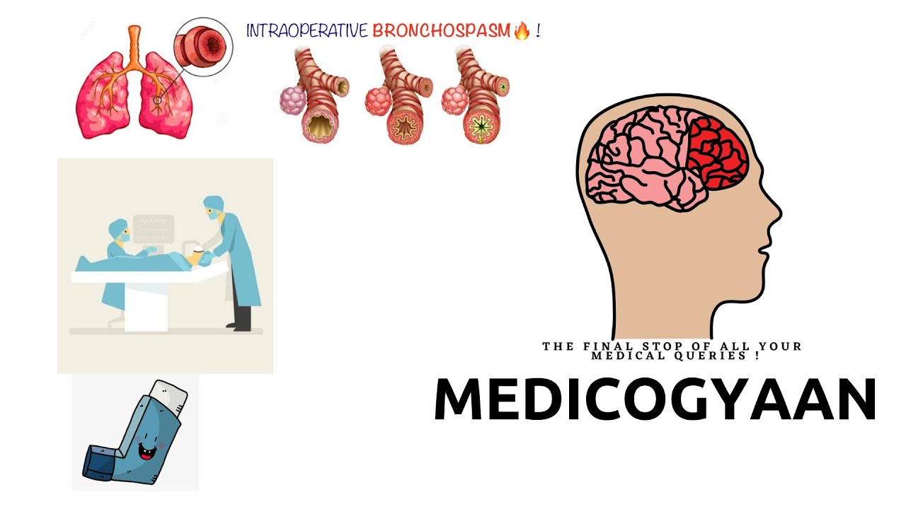 INTRAOPERATIVE BRONCHOSPASM - YouTube
