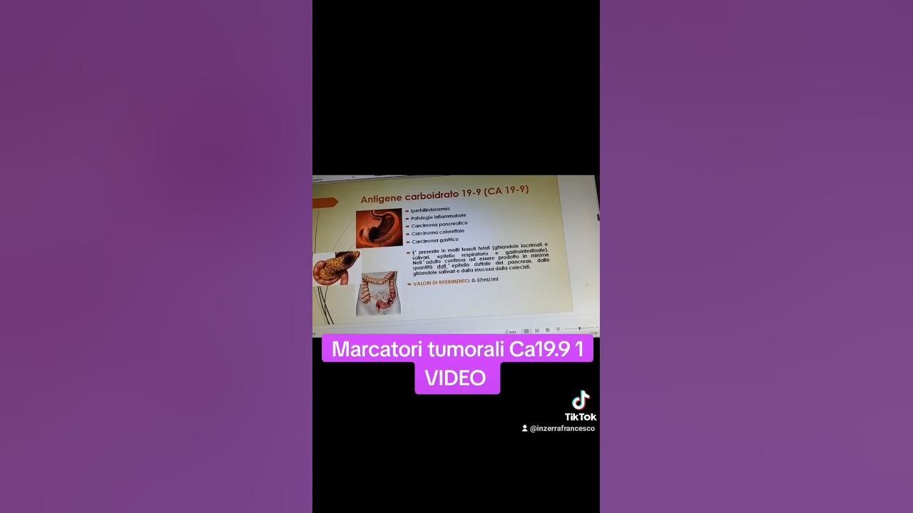 Marcatori tumorali CA19.9 - YouTube