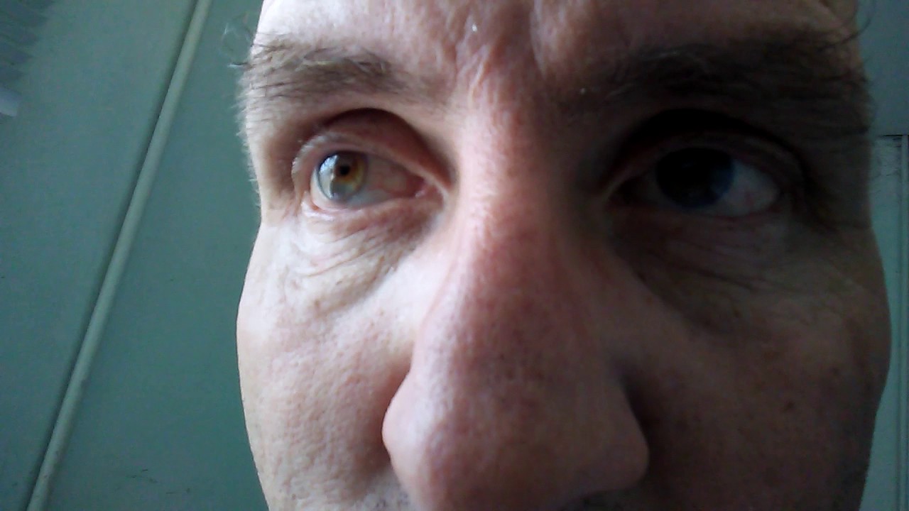 STIGMATA EYES 11-11-2016 - YouTube