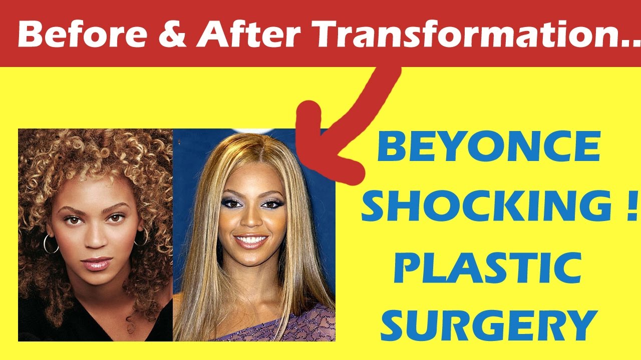 Beyonce Plastic Surgery Before and After Full HD - YouTube