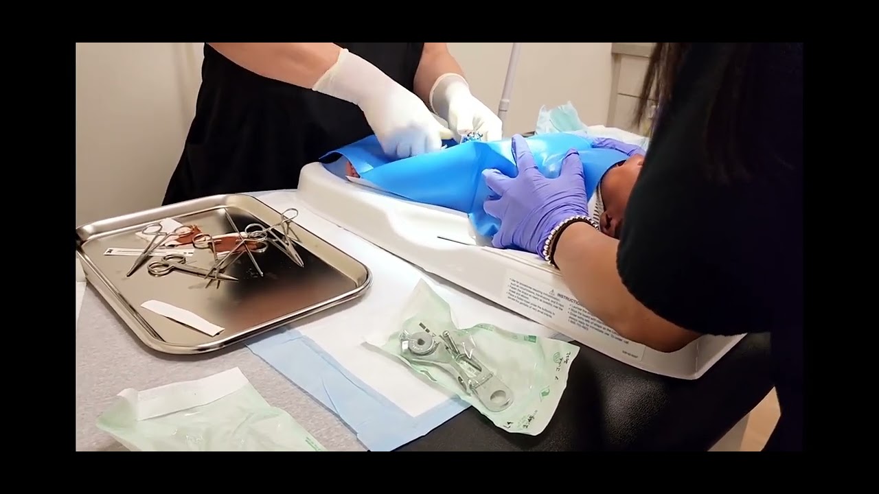 Gomco Circumcision Performed - YouTube