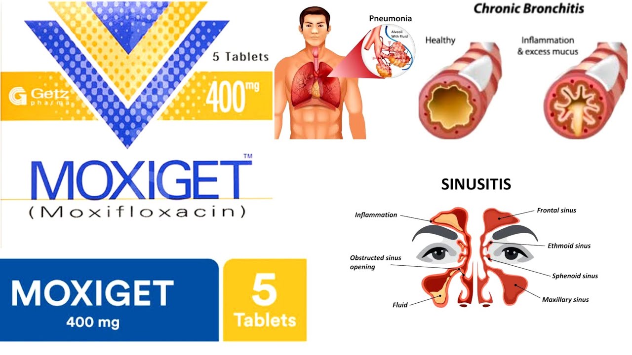 Moxiget moxifloxacin uses in Urdu Hindi - YouTube