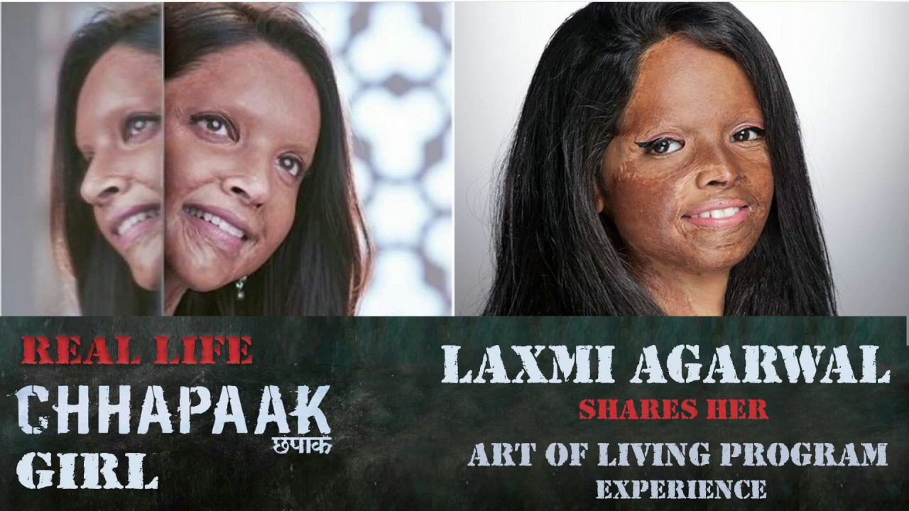 Real Life 'Chhapaak' Girl Laxmi Agarwal shares her Art of Living's ...