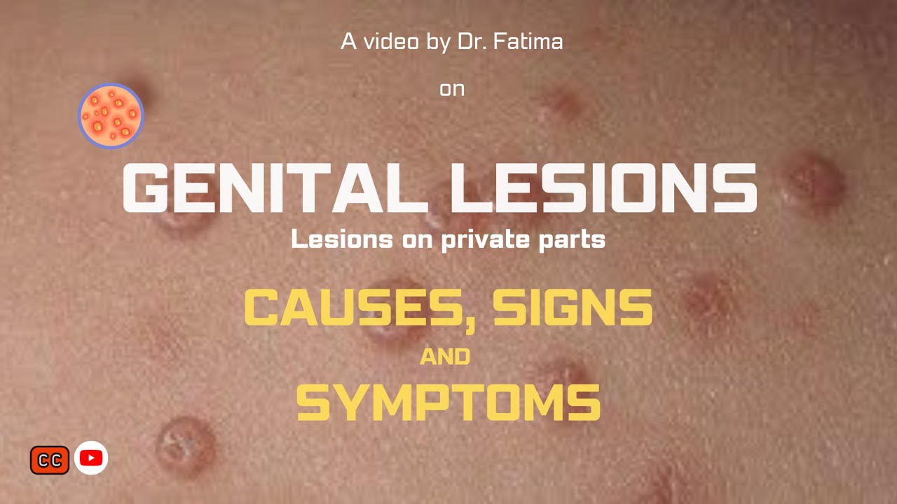 Spots on Private parts: Causes, Signs, and Symptoms - YouTube