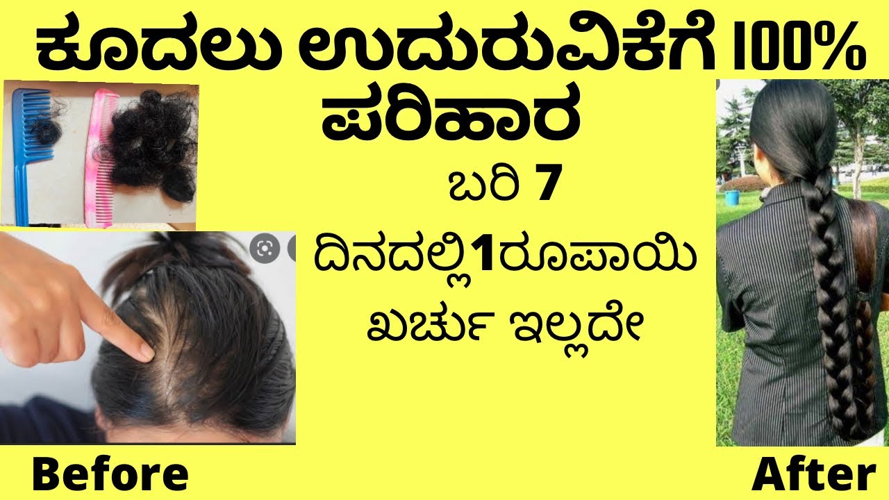 How To Stop Hair Fall Hair Fall Control In 7 Days Men And Whomen
