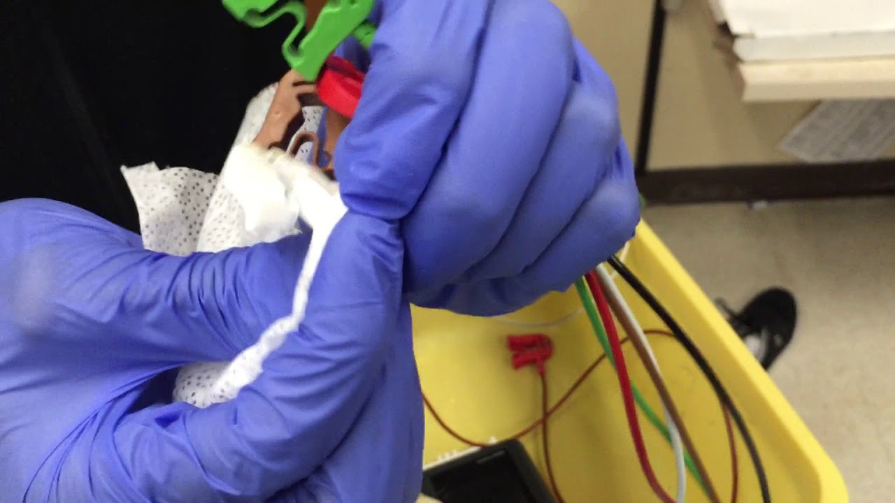 Proper Cleaning of Telemetry Cords 2018 - YouTube