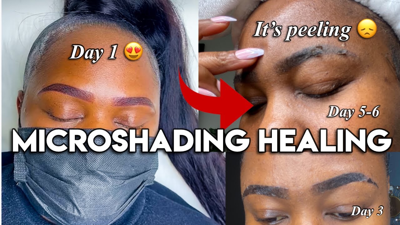 MICROSHADING HEALING DAY BY DAY PROCESS - YouTube
