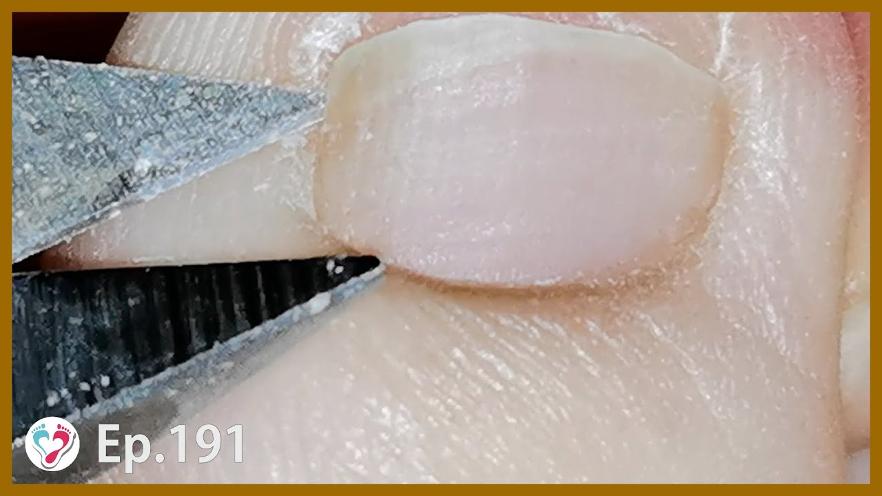 Ep.191 - Little Toenail Clipping A Very Close View - YouTube