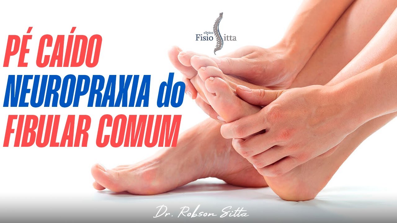 EXERCÍCIO de MOBILIZAÇÃO da FÍBULA PÉ CAÍDO NEUROPRAXIA - Clínica de ...