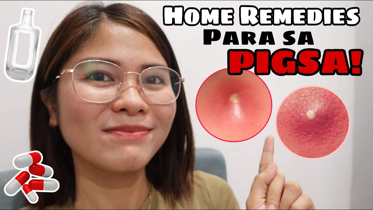 PIGSA / BOIL mga dapat gawin para hindi eto lumala 💊💜 - YouTube