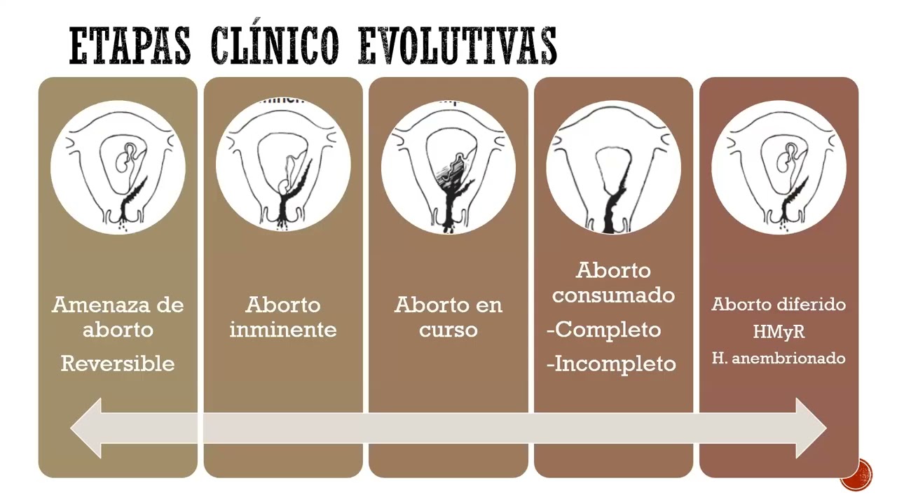 Metrorragias de la primera mitad - YouTube