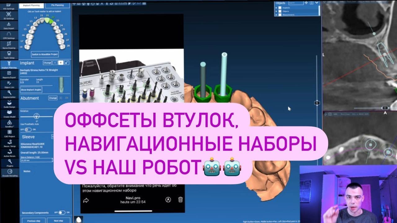 Втулки и оффсеты навигационных наборов в Real Guide, - Что с этим ...