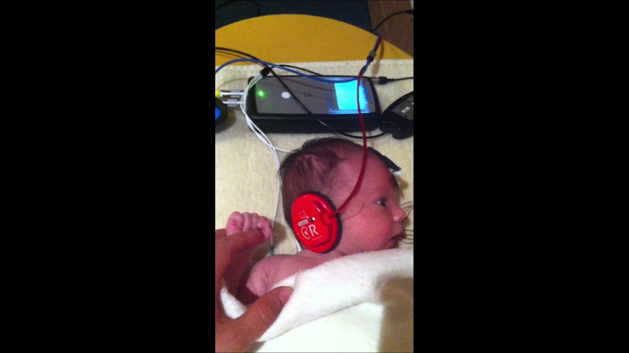 Potencials Evocats Auditius de Tronc Cerebral (PEATC) - YouTube