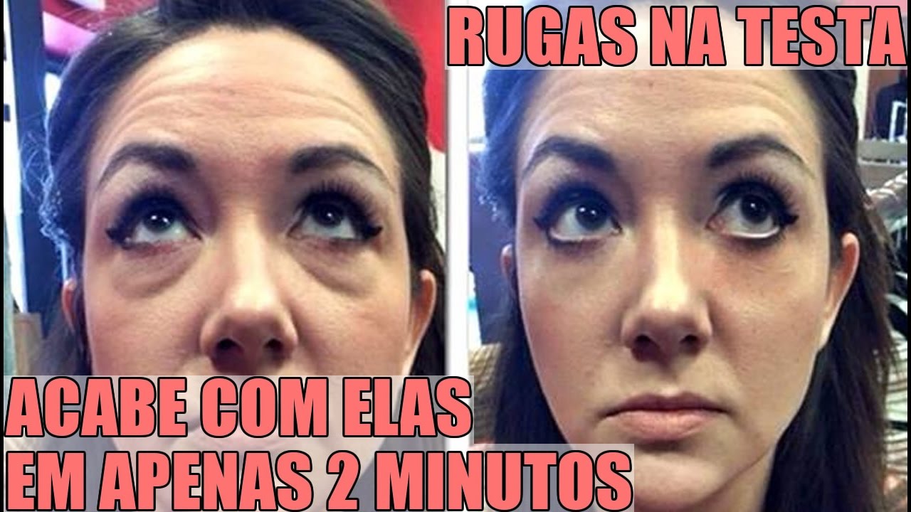 Rugas Na Testa - Acabe Com Ela Em Apenas 2 Minutos - YouTube