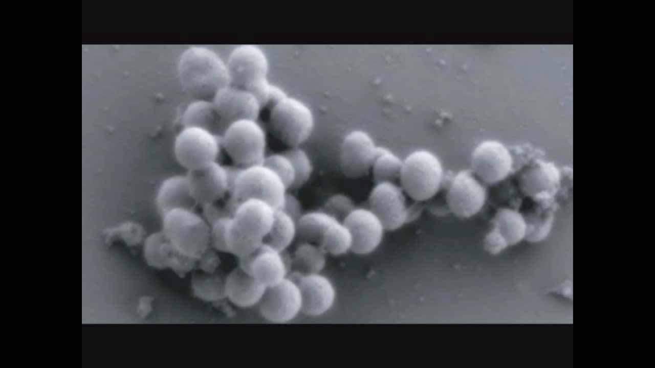 THE GULF BLUE PLAGUE: IT'S NOT WISE TO FOOL MOTHER NATURE (Full length ...