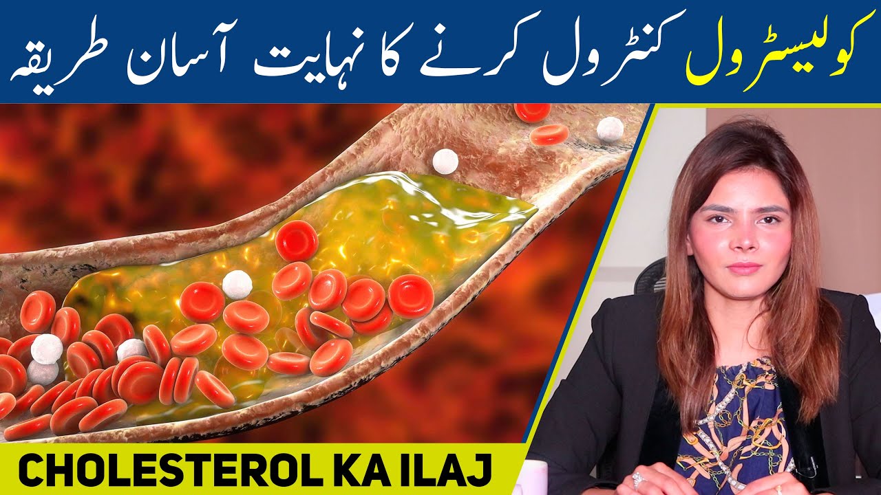 High Cholesterol Treatment Urdu Cholesterol Kam Karne Ka Tarika
