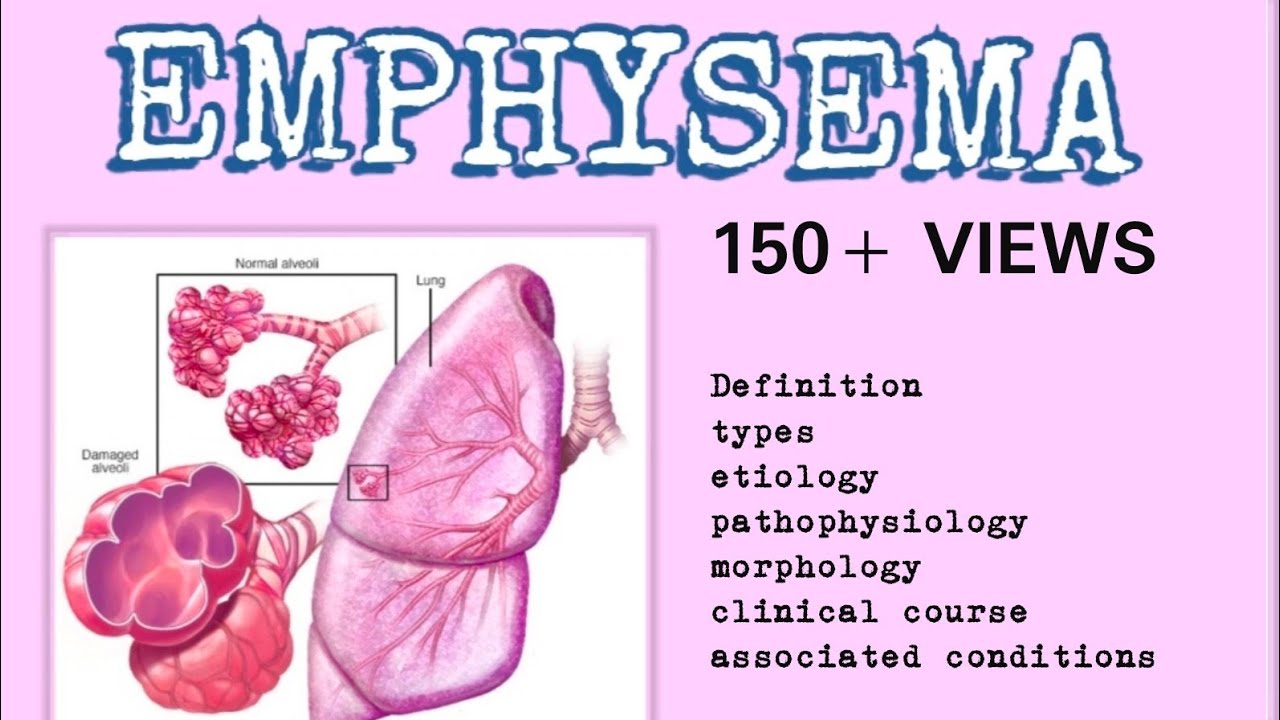 EMPHYSEMA - YouTube