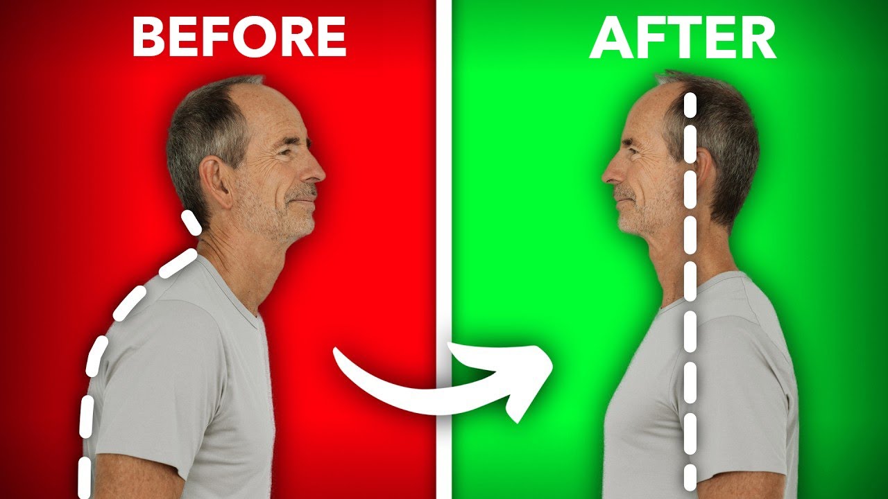 Bad posture: 4 exercises for an impressive posture! - YouTube