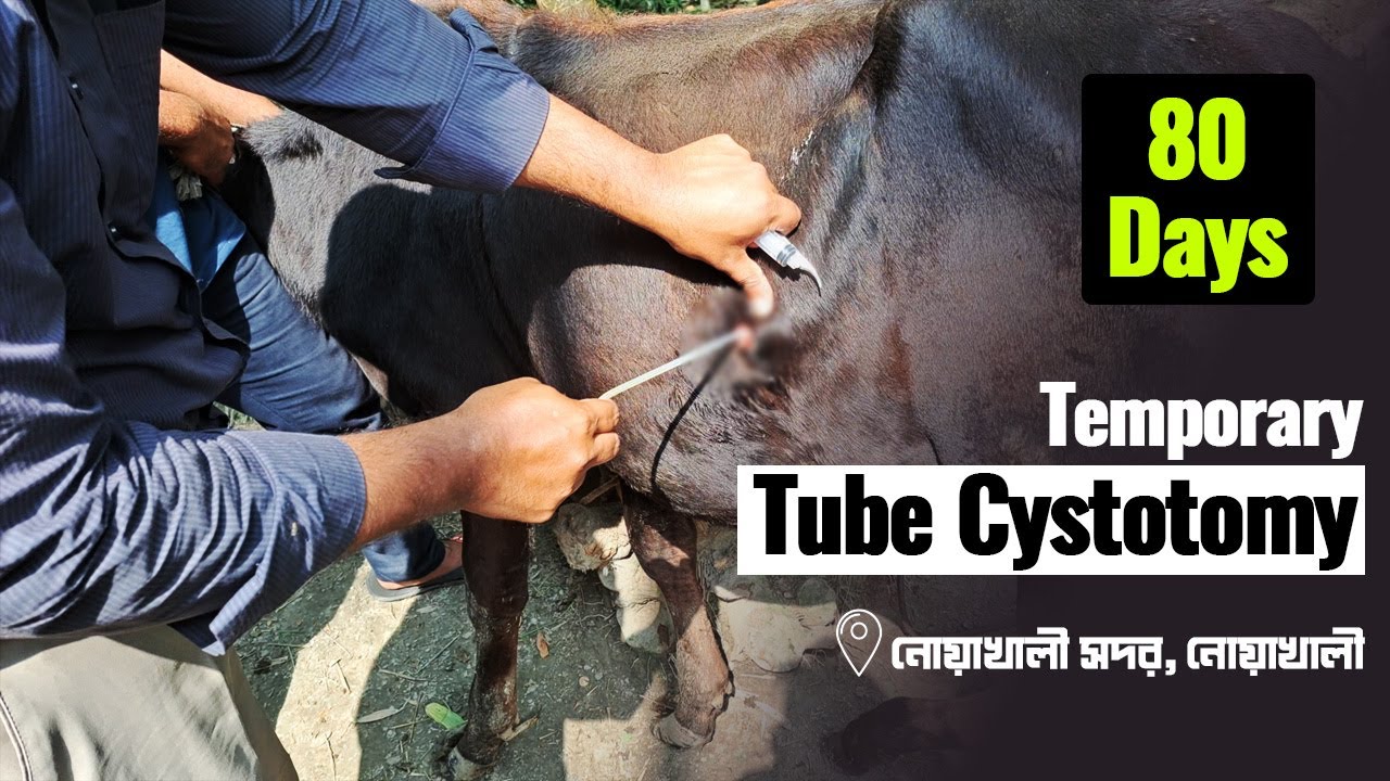 Temporary Tube Cystotomy | Dr. Md. Abu Bakar Ahad - YouTube