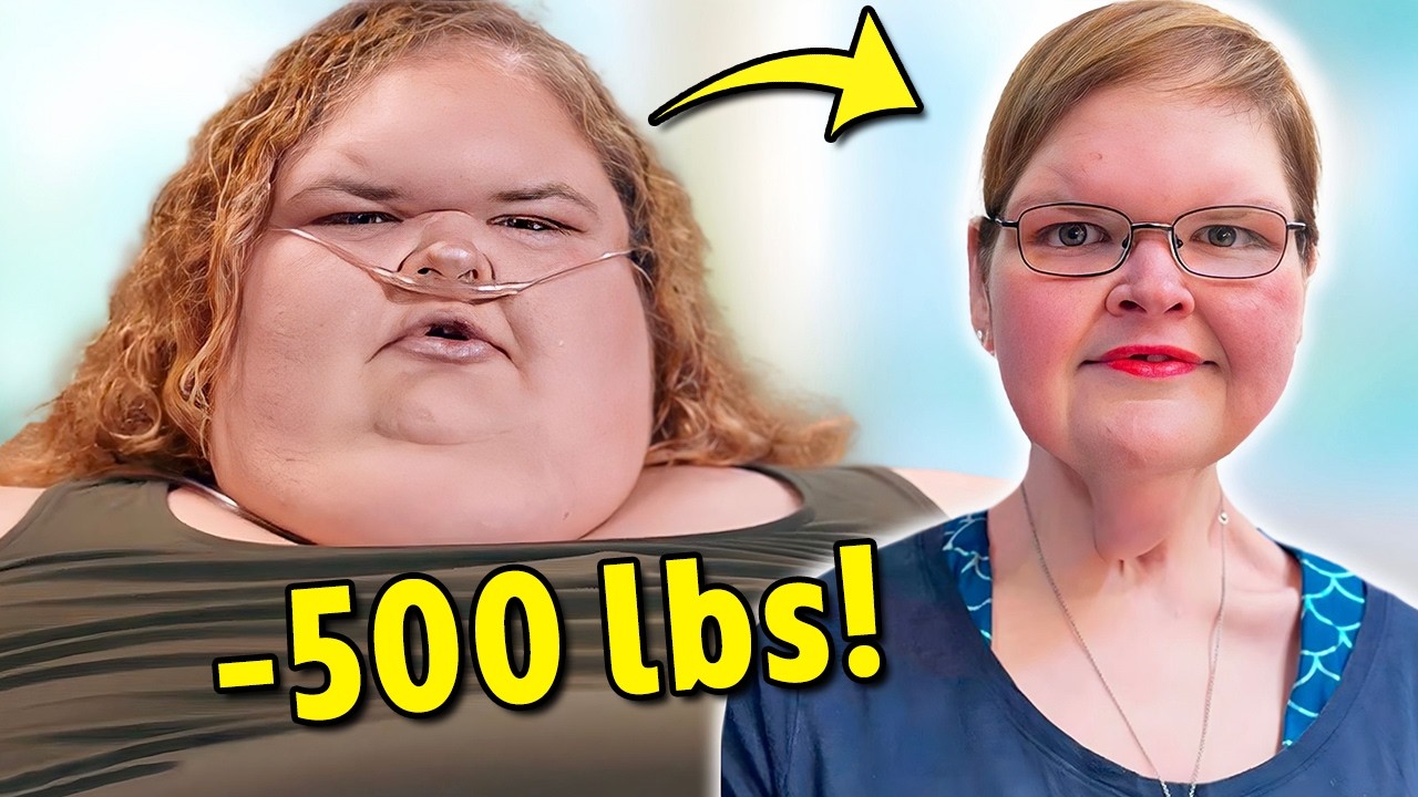 Doctor DENIES Tammy's Skin Removal Surgery AGAIN | 1000-lb Sisters ...