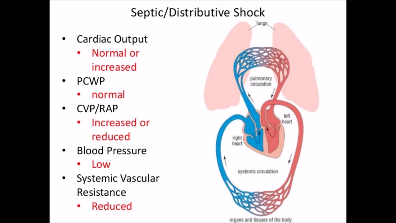 Hemodynamic & Circulatory Shock - Distributive - YouTube