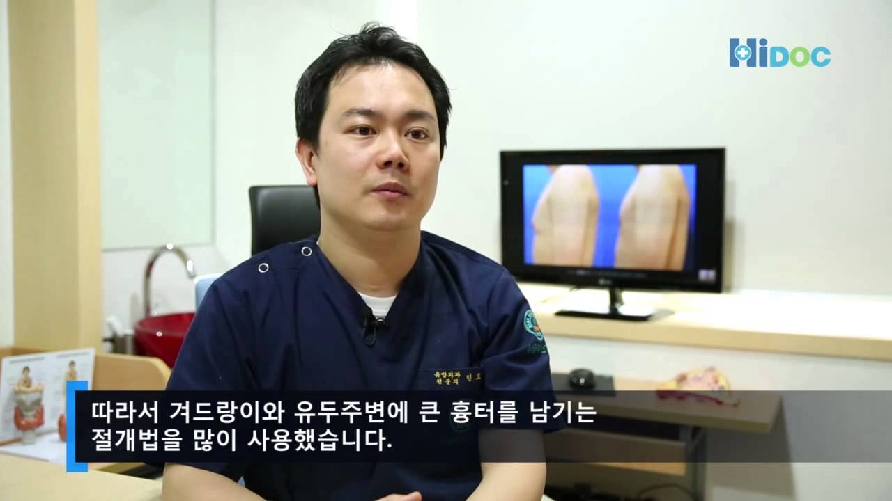 부유방(Polymastia) - YouTube