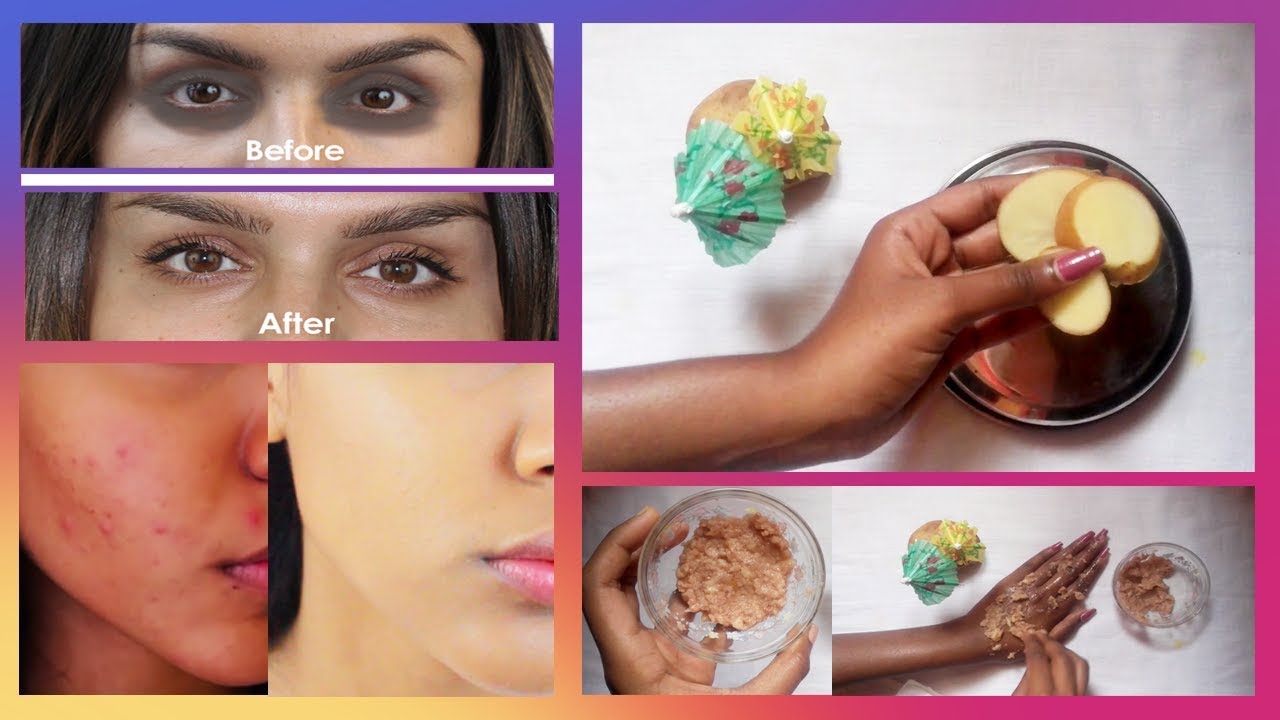 Potato face pack for all your problems | Dark circle, Pigmentation, Sun ...