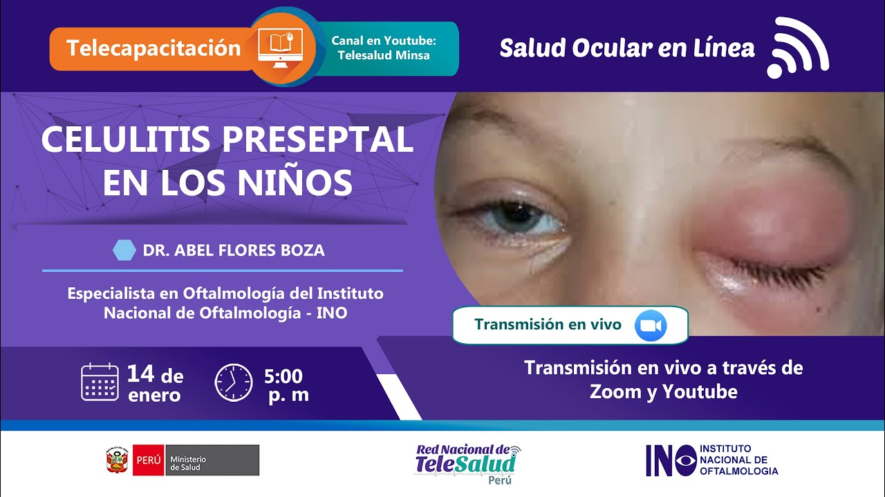 CELULITIS PRESEPTAL EN LOS NIÑOS - Salud Ocular en Línea del INO - YouTube