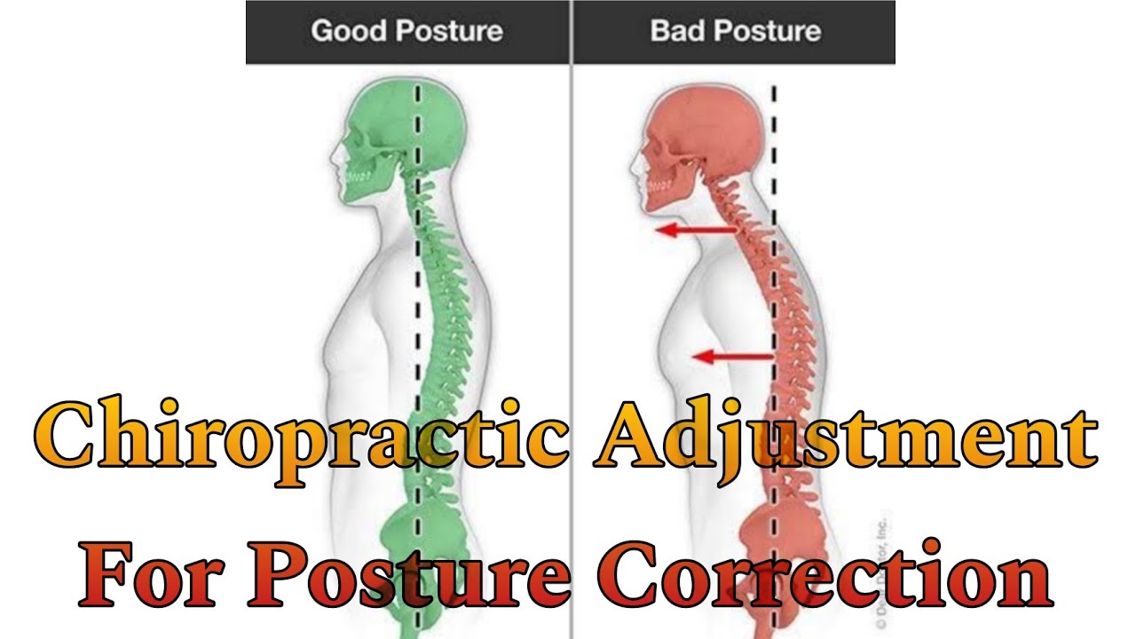 Chiropractic Adjustment for Posture Correction@AyurPrabhaWellness # ...